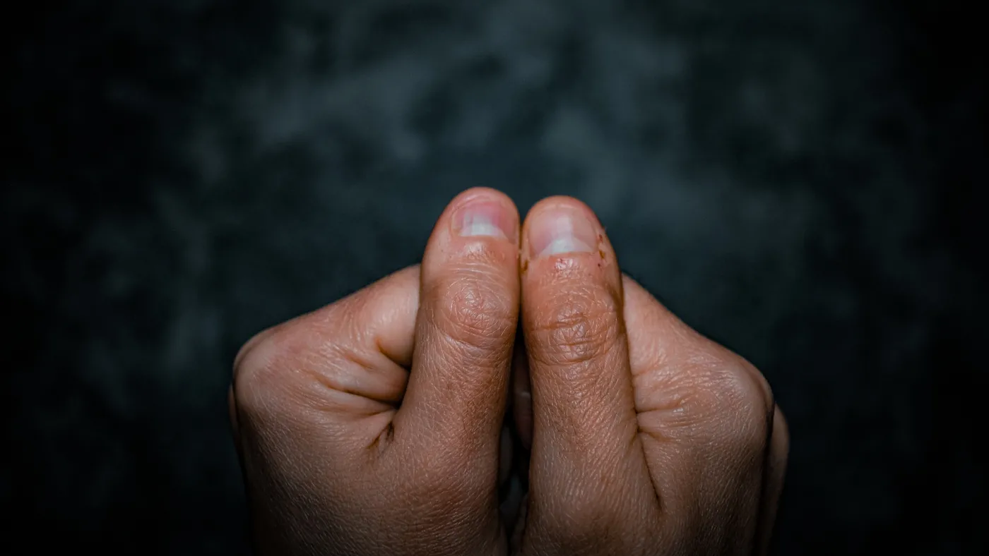 10+ Signs Your Nails Are In Bad Shape - Go Social